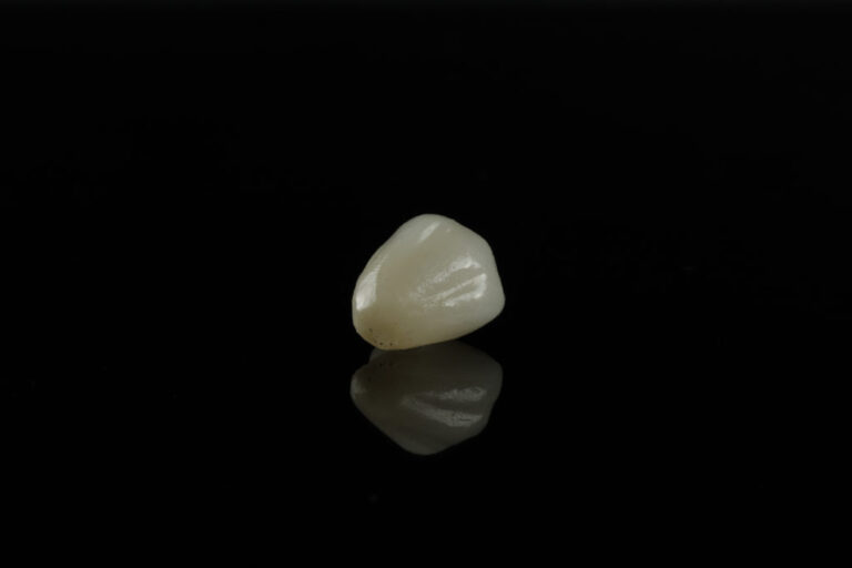 What are Craze Lines? | Hawaii Family Dental